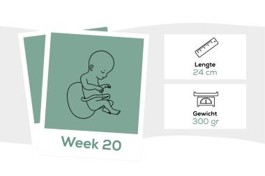 Bandenpijn tijdens je zwangerschap | WIJ.nl