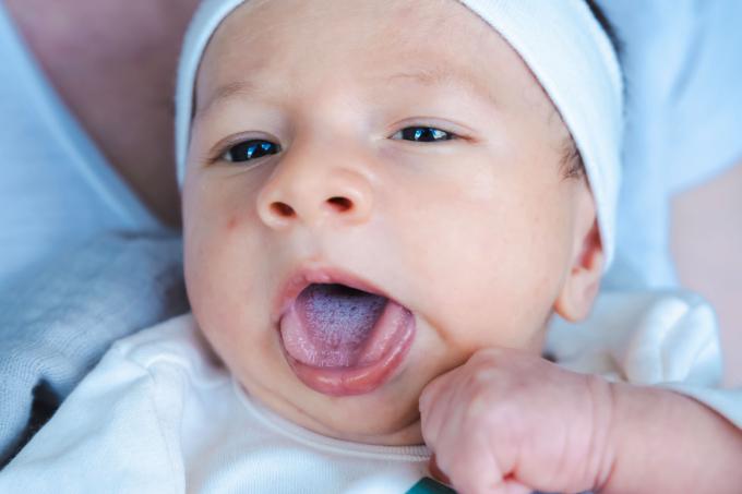 Spruw bij je baby: oorzaken & behandeling | WIJ.nl