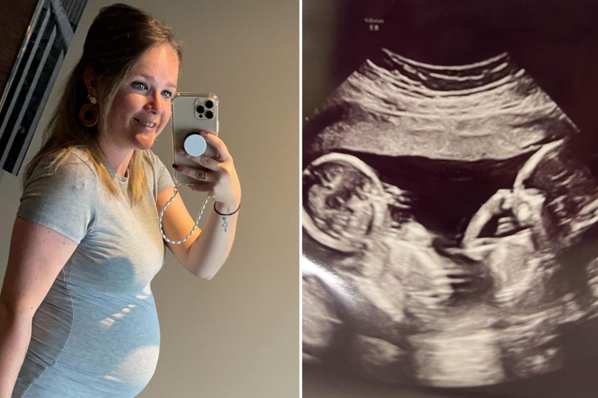 Dankzij IVF ICSI zwanger van een tweeling | WIJ.nl.